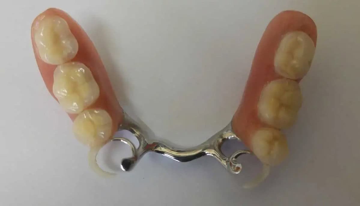Scopri le migliori protesi mobili - Studio Dentistico